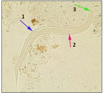 Questão 3338165 Instituto Consulplan - 2024 - Biomédico (Pref Cacoal)